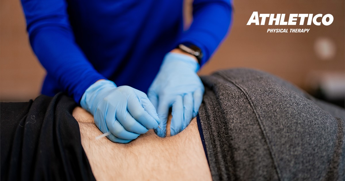 Try Dry Needling for Your New Year’s Resolutions