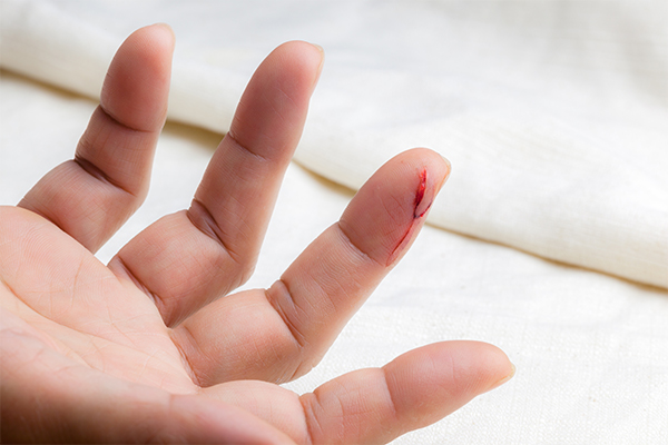 4 Common Fingertip Injuries - Athletico