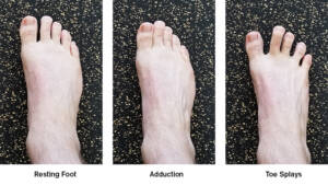 Take Control of Your Feet - Athletico