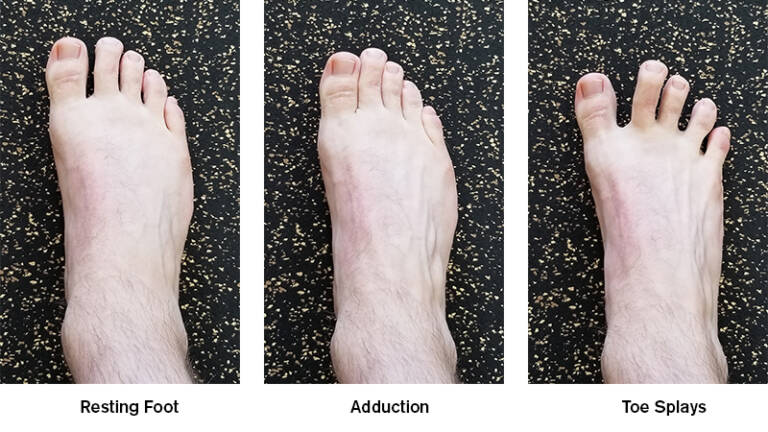 Take Control of Your Feet - Athletico