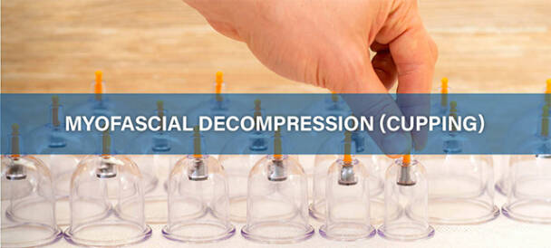 Myofascial Decompression (Cupping) - Athletico