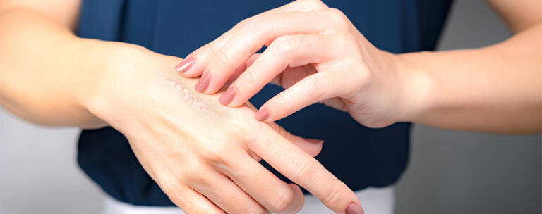 Healing Beyond the Surface: How Therapy Transforms Painful Scars ...